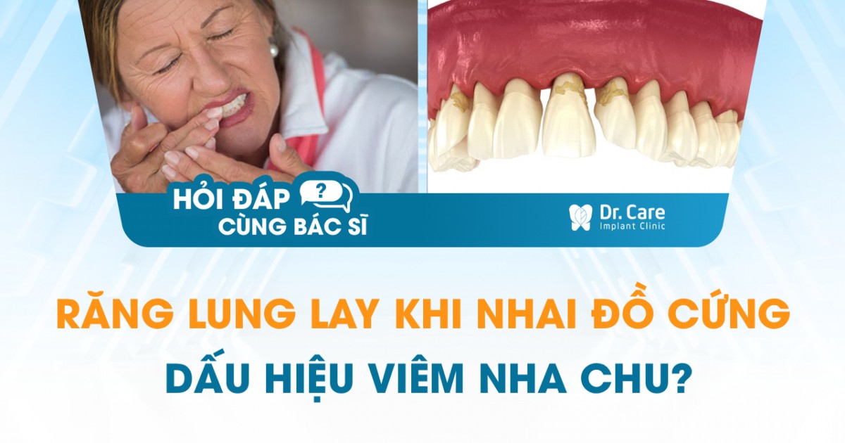 [HỎI ĐÁP BÁC SĨ] – Răng lung lay khi nhai đồ cứng: Dấu hiệu viêm nha ...