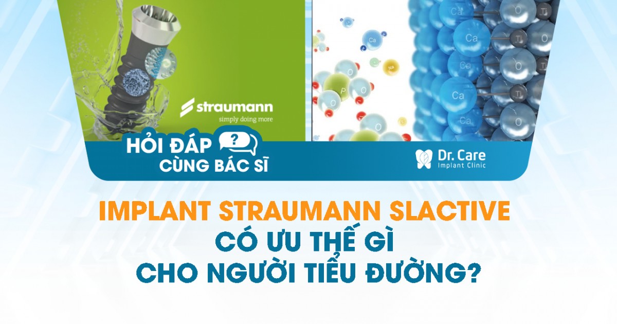 [HỎI ĐÁP BÁC SĨ] – Implant Straumann SLActive có ưu thế gì cho người ...