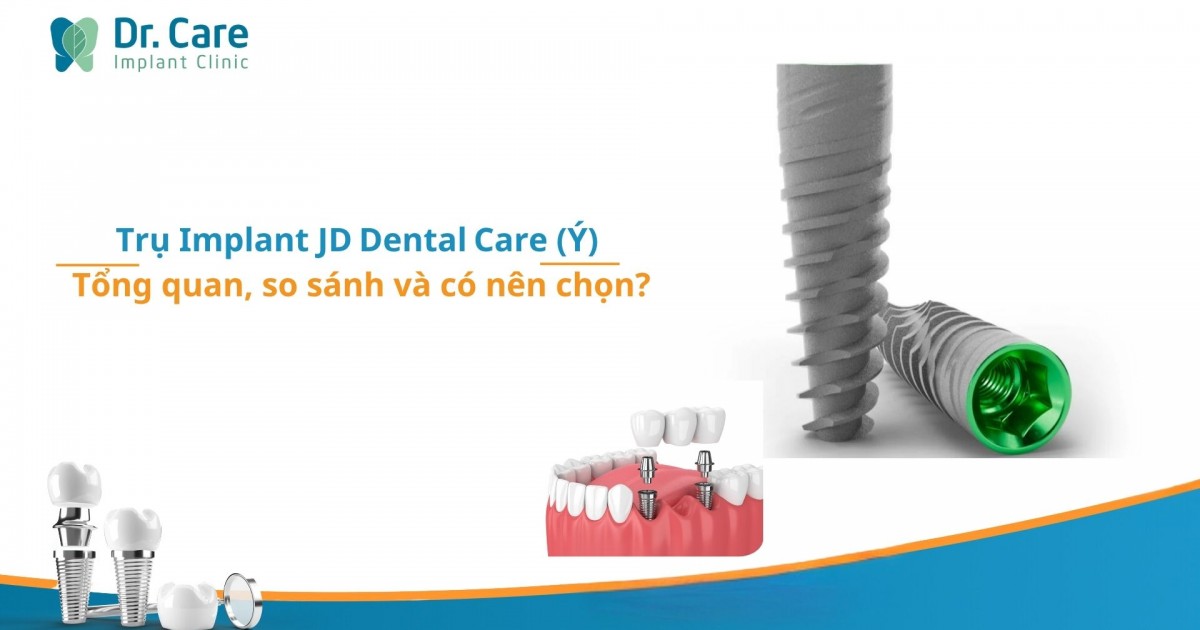 Trụ Implant JD Dental Care (Ý) – Tổng quan, so sánh và có nên lựa chọn ...