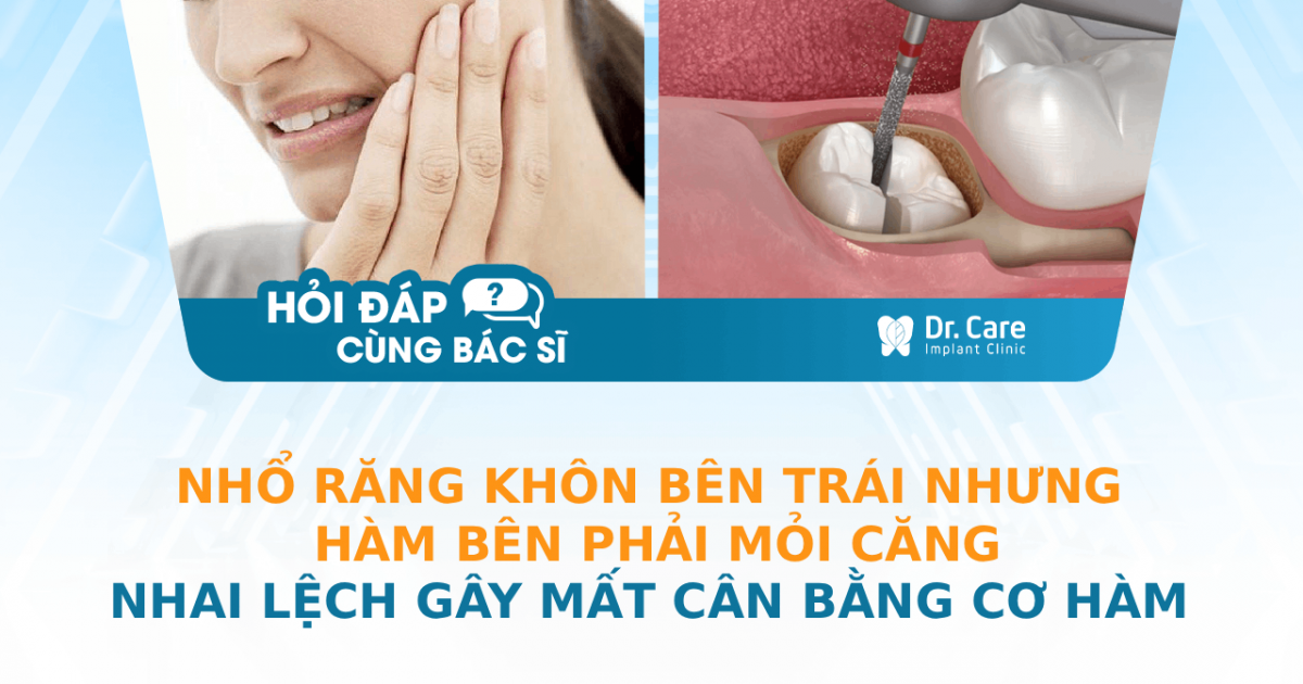 [HỎI ĐÁP BÁC SĨ] - Nhổ Răng Khôn Bên Trái Nhưng Hàm Bên Phải Mỏi Căng ...